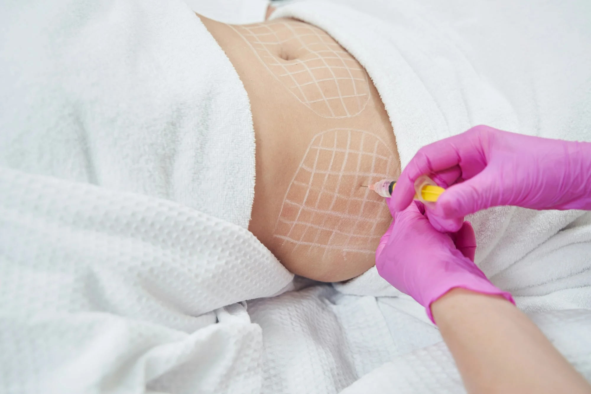 Fat Melting | Opulence Clinic | Best Aesthetic Clinic In Kota Kinabalu