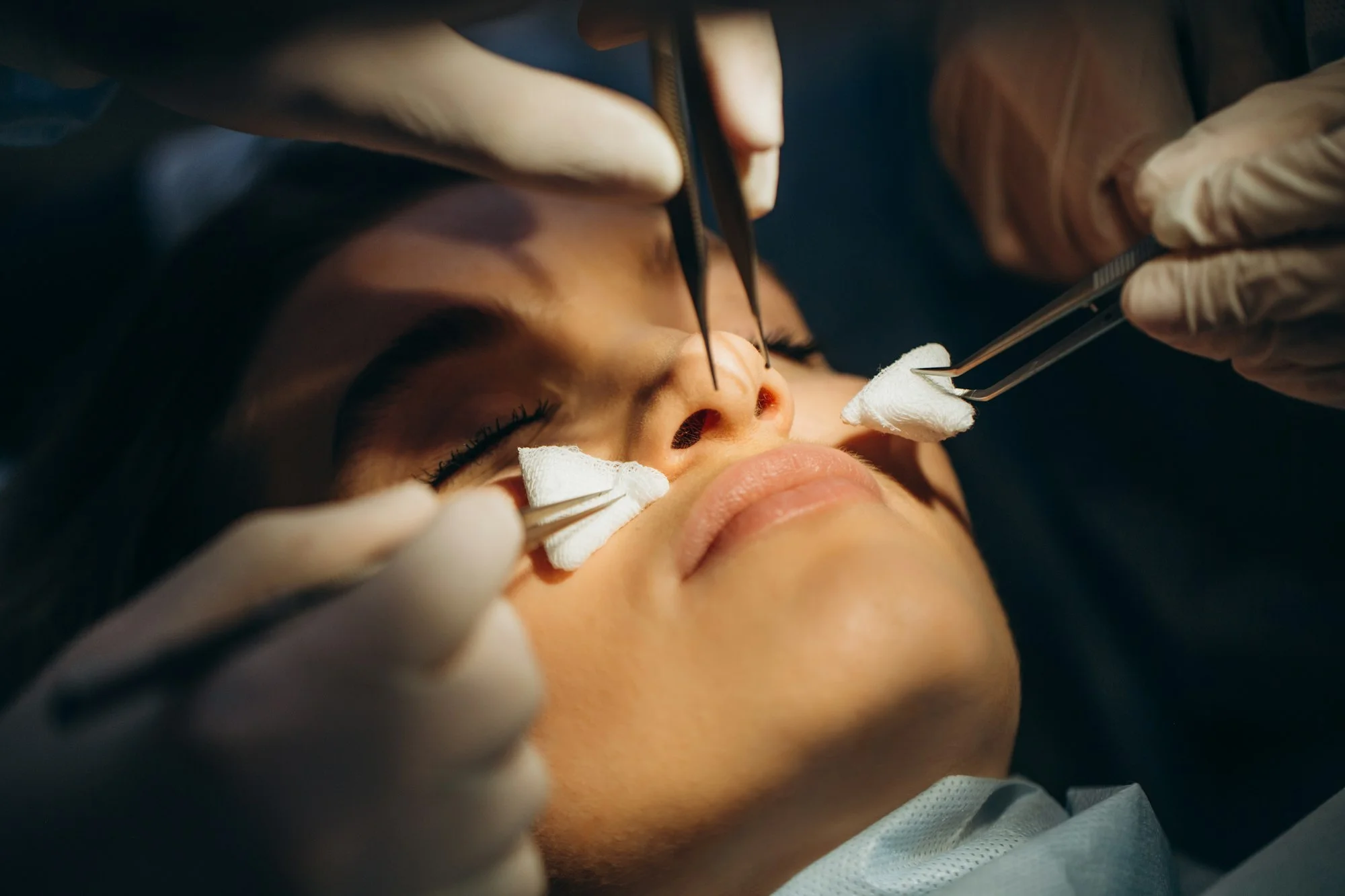 Nose Reshaping | Opulence Clinic | Best Aesthetic Clinic In Kota Kinabalu